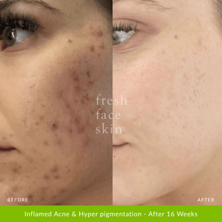 Fresh Face Skin Recovery Mask: Soothe, Calm, and Strengthen Your Skin