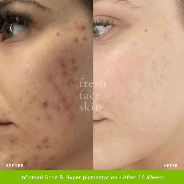 Fresh Face Skin – Salon-Grade Natural Skincare for Healthy, Resilient