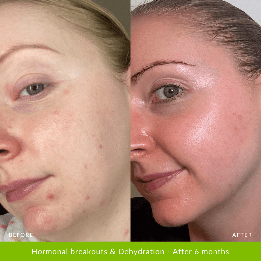 Fresh Face Skin Recovery Mask: Soothe, Calm, and Strengthen Your Skin