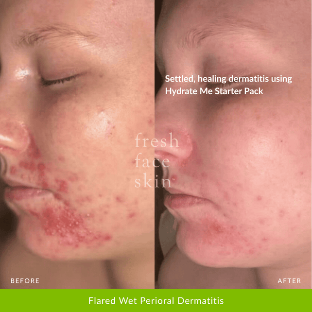 Fresh Face Skin – Salon-Grade Natural Skincare for Healthy, Resilient