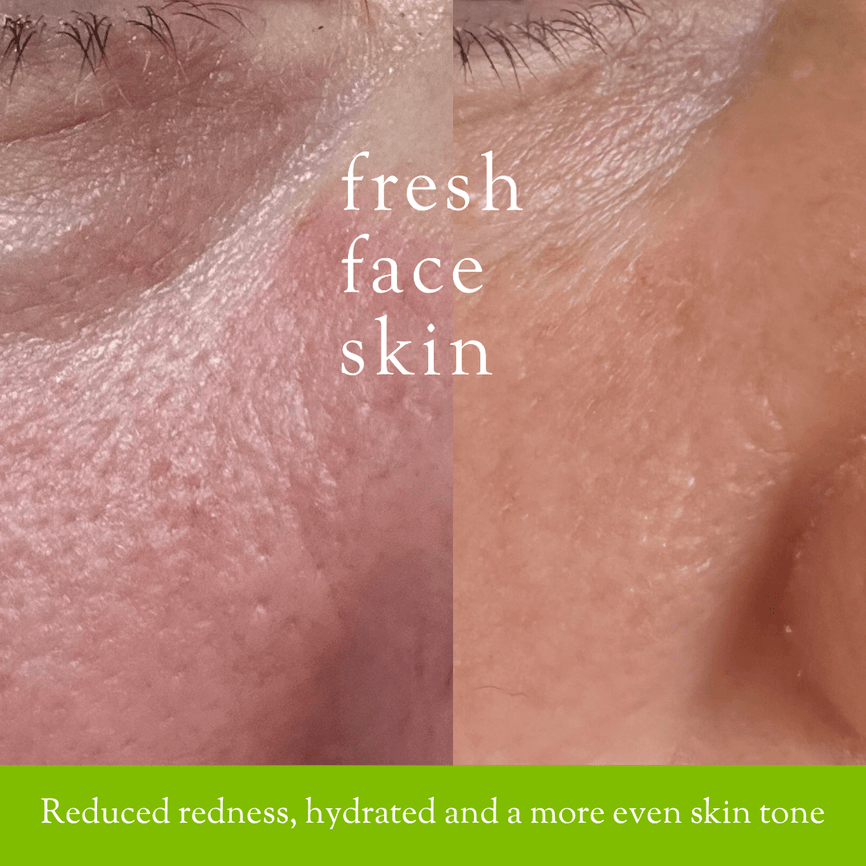 Fresh Face Skin - All natural treatments, cleansers and enhancers