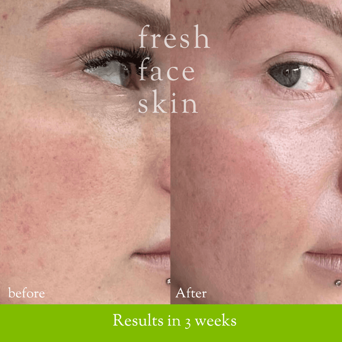 Skin Barrier Repair Pack | Strengthen & Protect Sensitive Skin ...