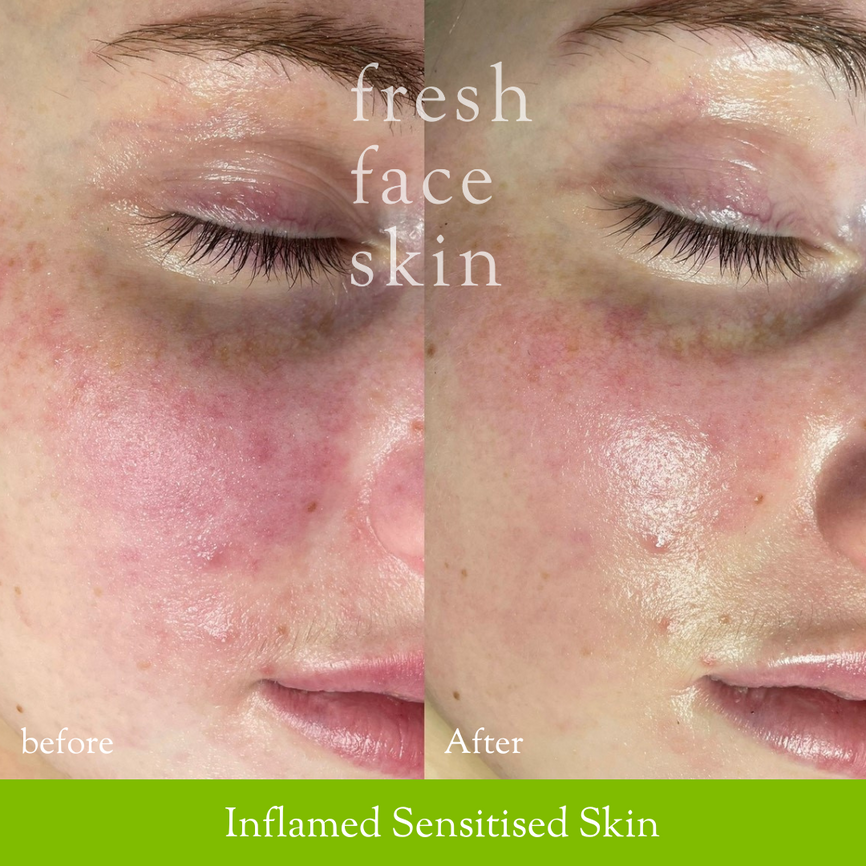 Fresh Face Skin - All natural treatments, cleansers and enhancers