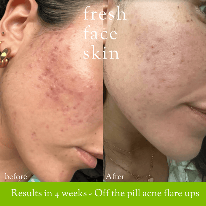 Fresh Face Skin – Salon-Grade Natural Skincare for Healthy, Resilient